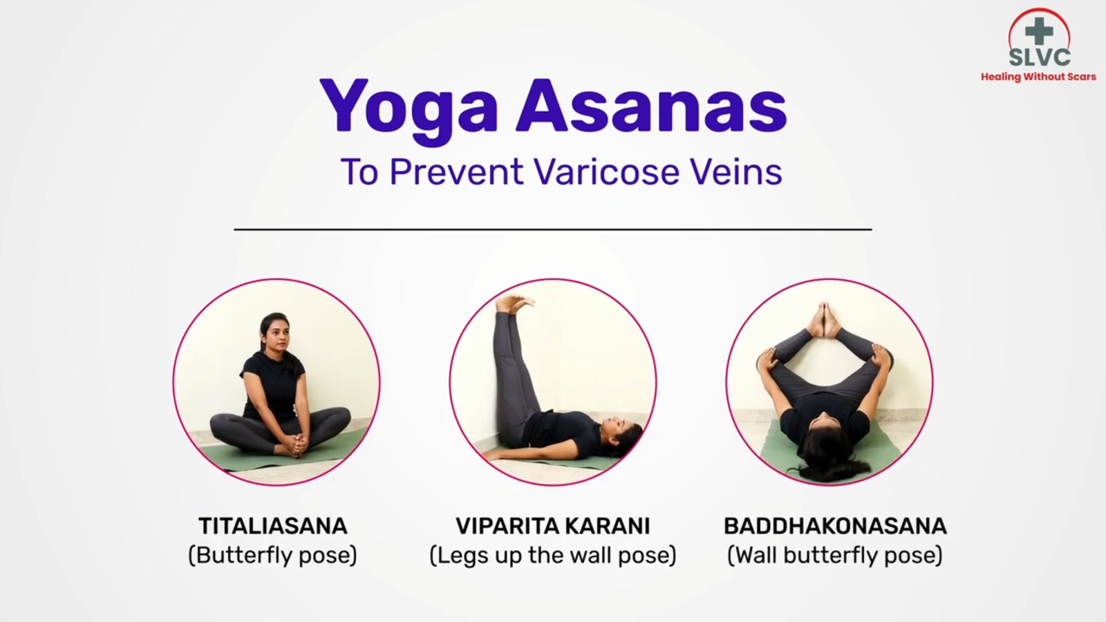 The Importance of Exercise and Yoga in Managing Varicose Veins