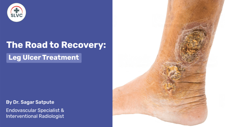The Road to Recovery: Leg Ulcer Treatment.